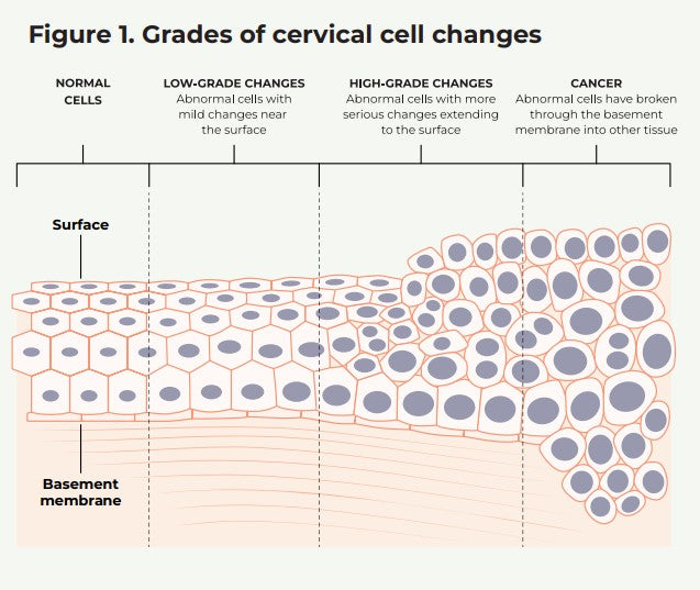Cervical screening: what you need to know English HE1161 – HealthEd
