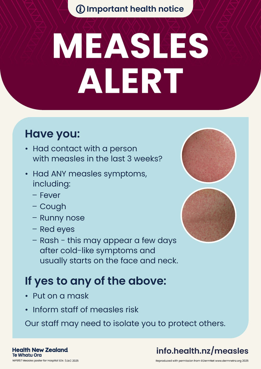 Measles alert - Hospital Emergency Departments - NIP9157 – HealthEd